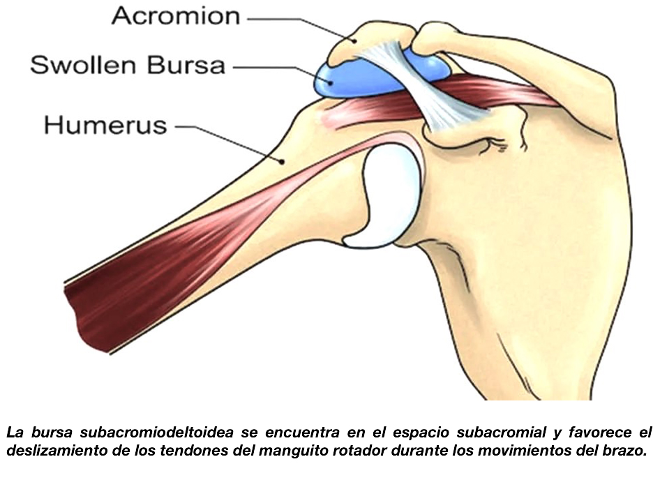 Bursitis subacromial - Synergia